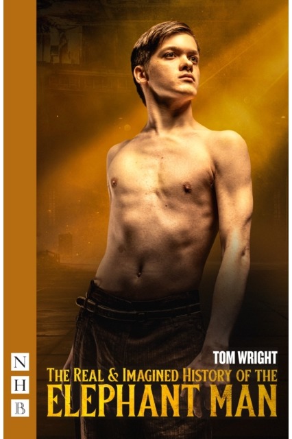 Real & Imagined History of the Elephant Man | Pegasas