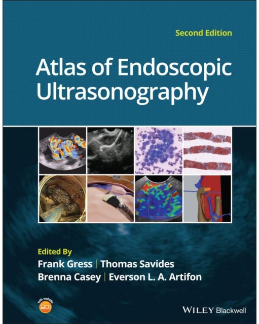 Atlas of Endoscopic | Pegasas